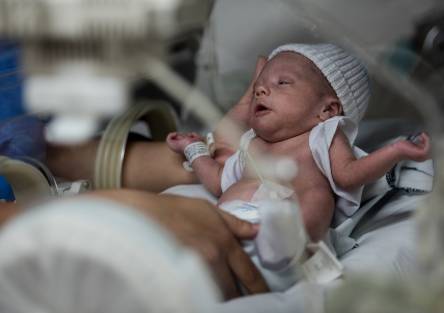 Signs and Symptoms of Congenital CMV